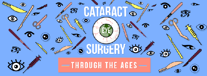 History of Cataract Surgery [Infographic]