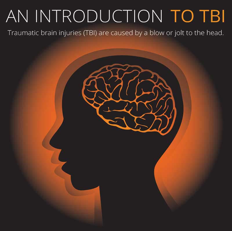 An Introduction To TBI [Infographic]